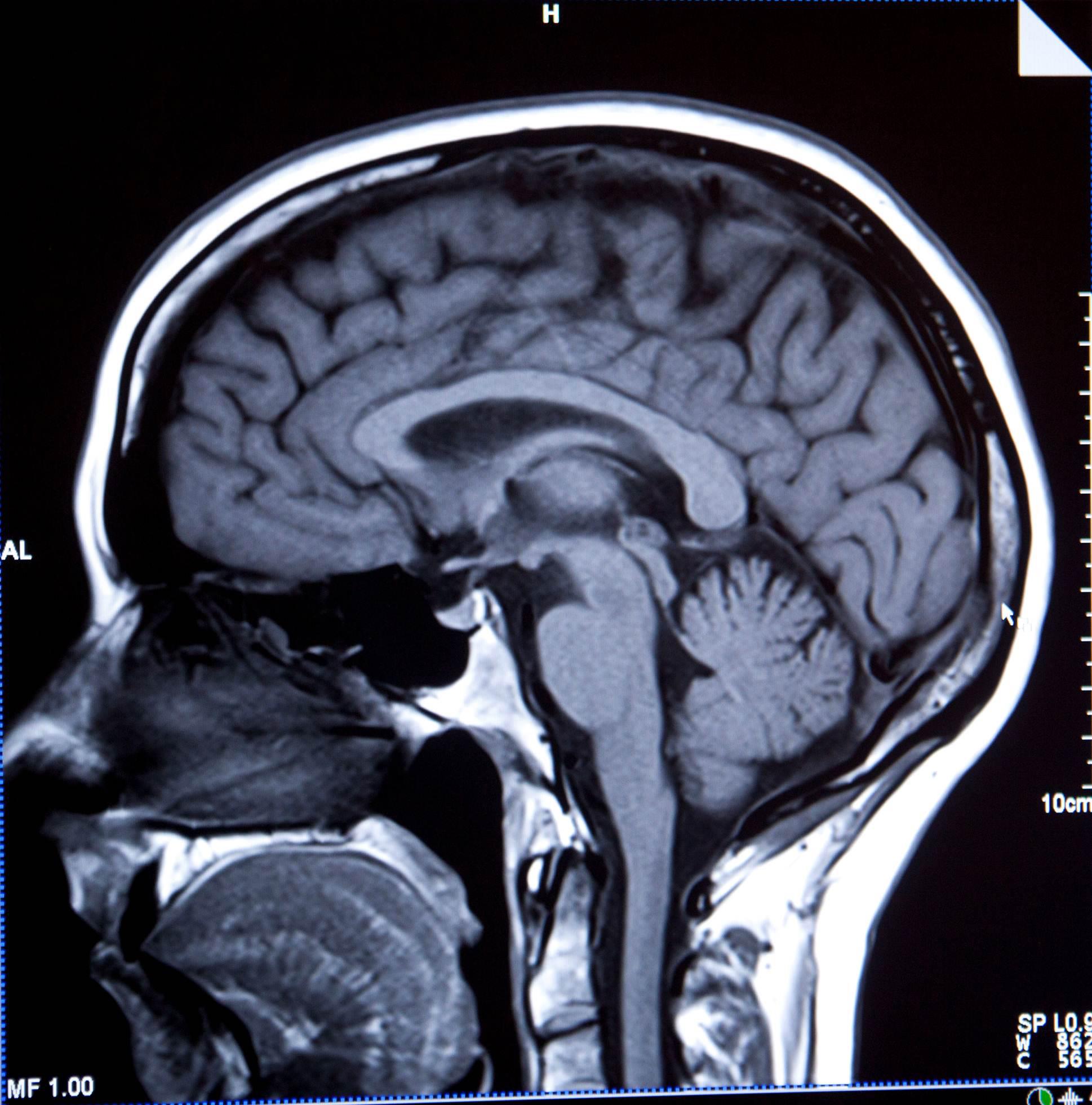 Magnetic Resonance Imaging (MRI) | South Jersey Radiology